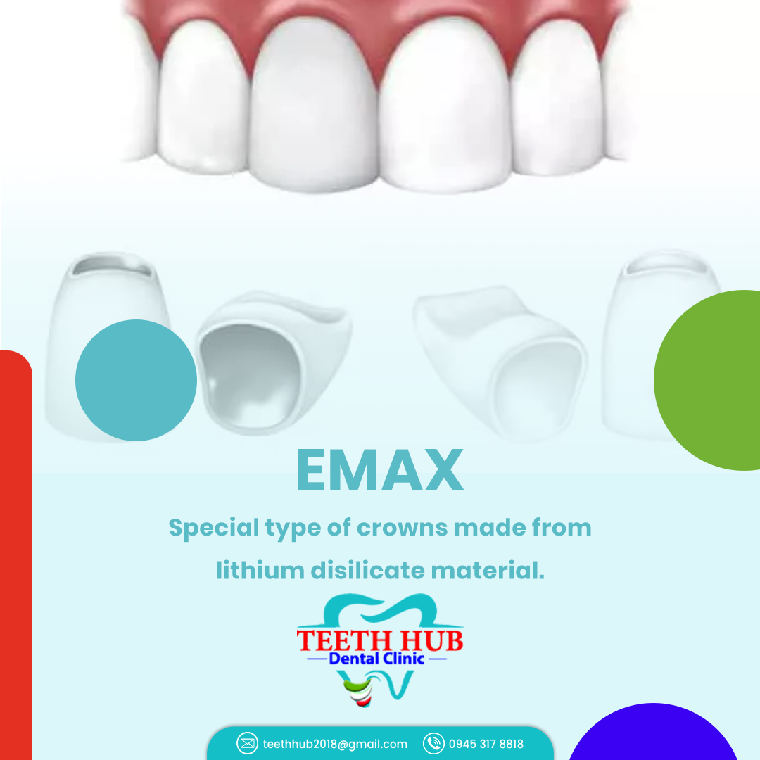 Teeth hub dental - The leading affordable dental clinic in Makati City