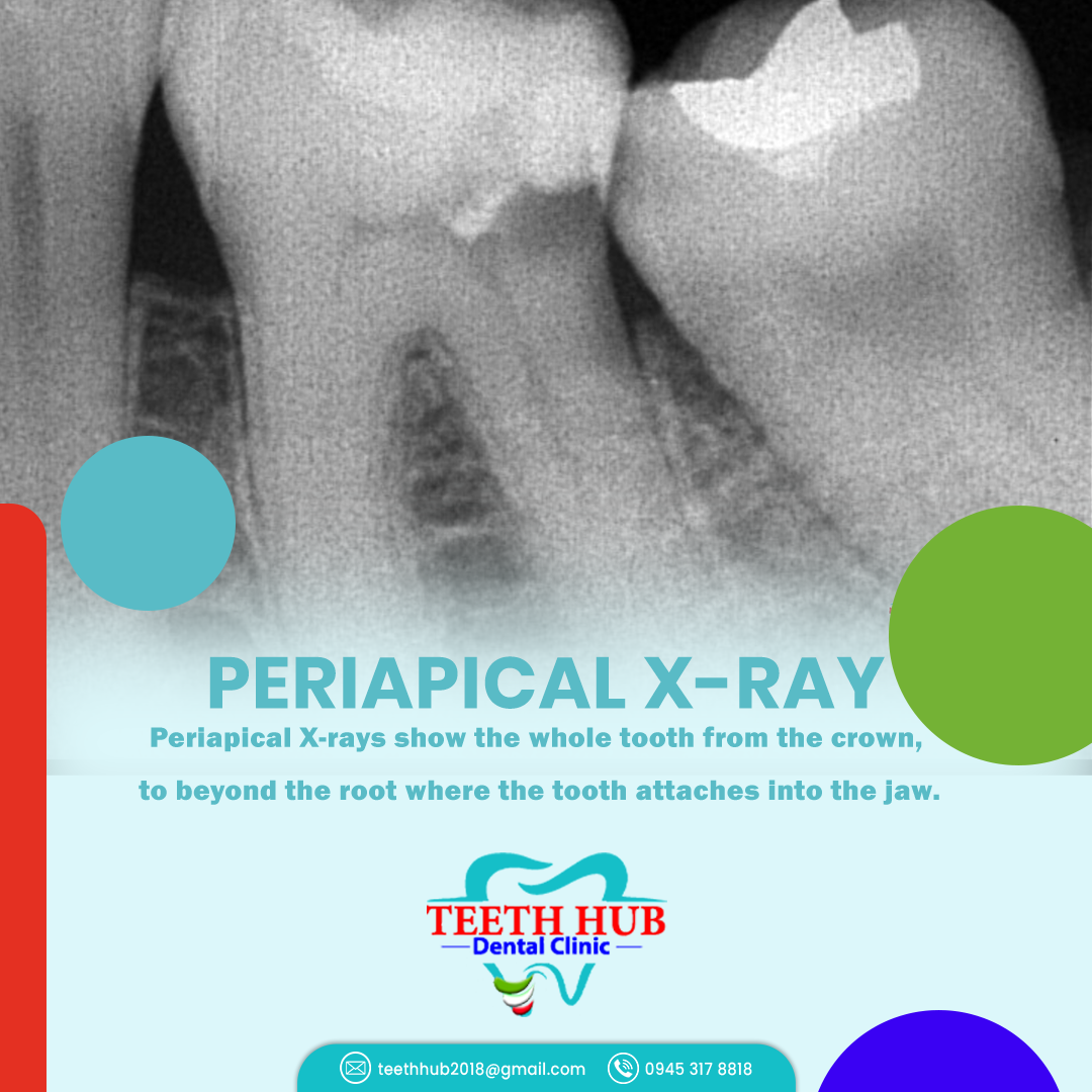 Teeth hub dental - The leading affordable dental clinic in Makati City