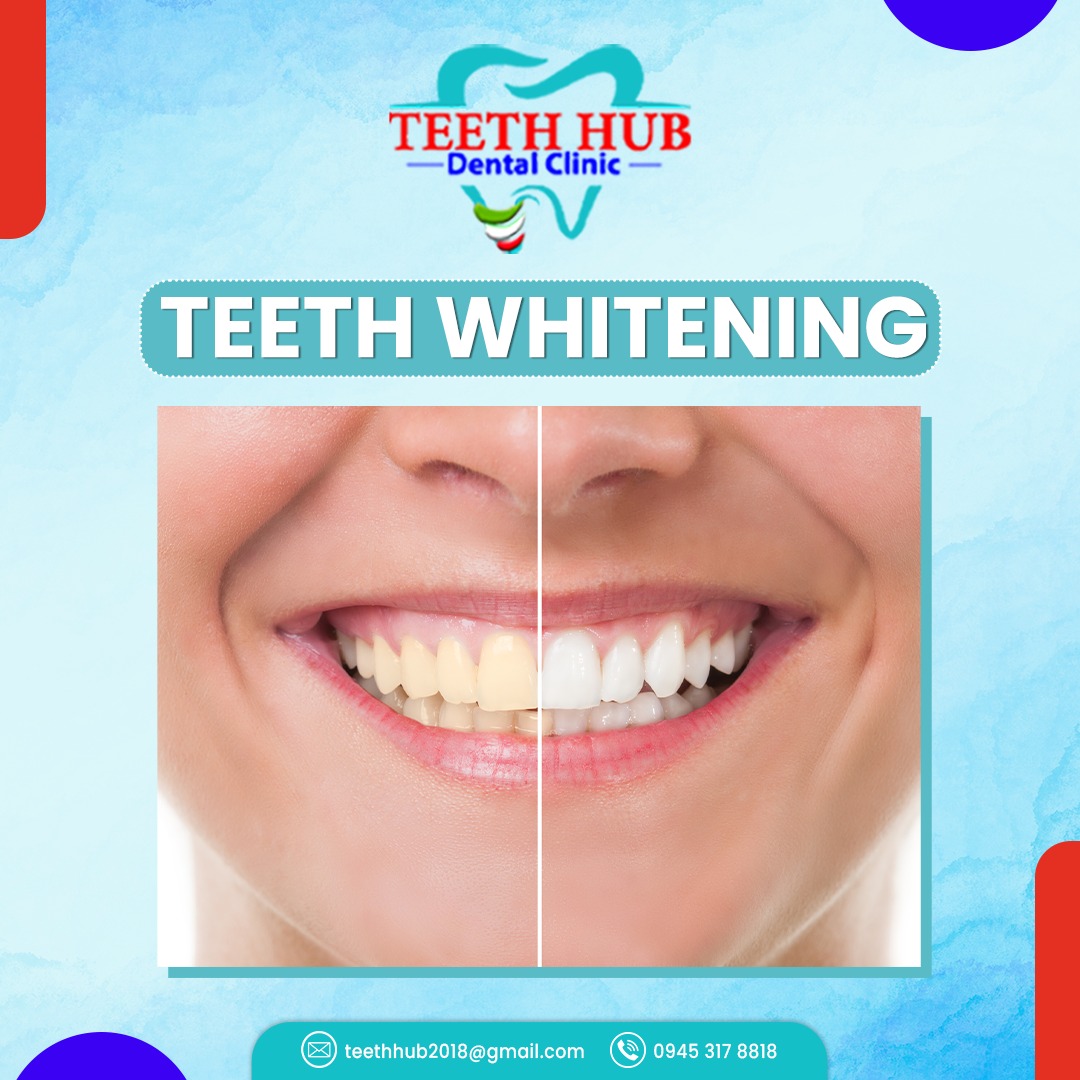 Teeth hub dental - The leading affordable dental clinic in Makati City