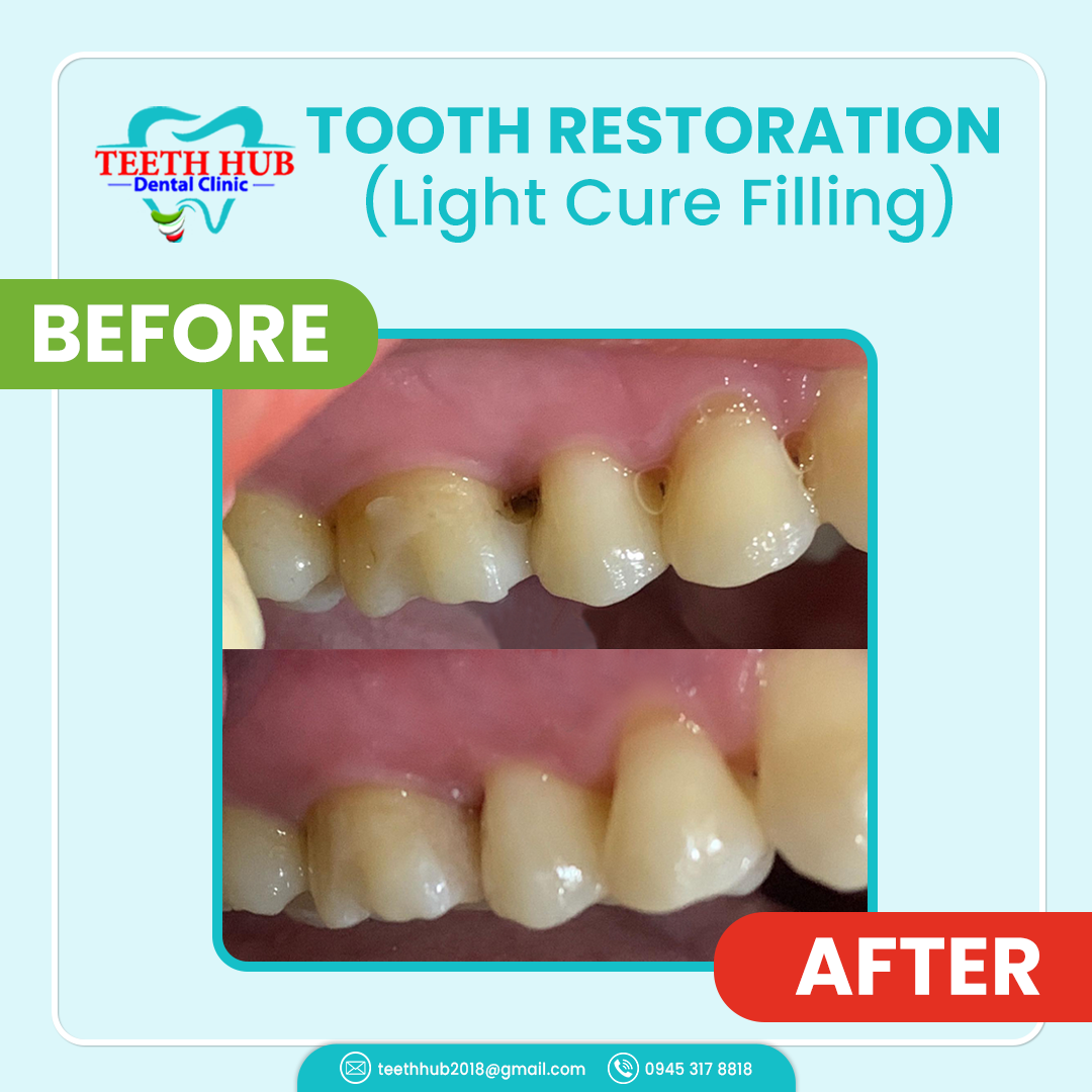 Teeth hub dental - The leading affordable dental clinic in Makati City