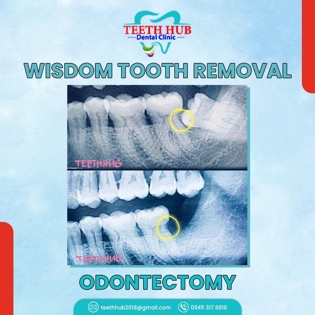 Teeth hub dental - The leading affordable dental clinic in Makati City